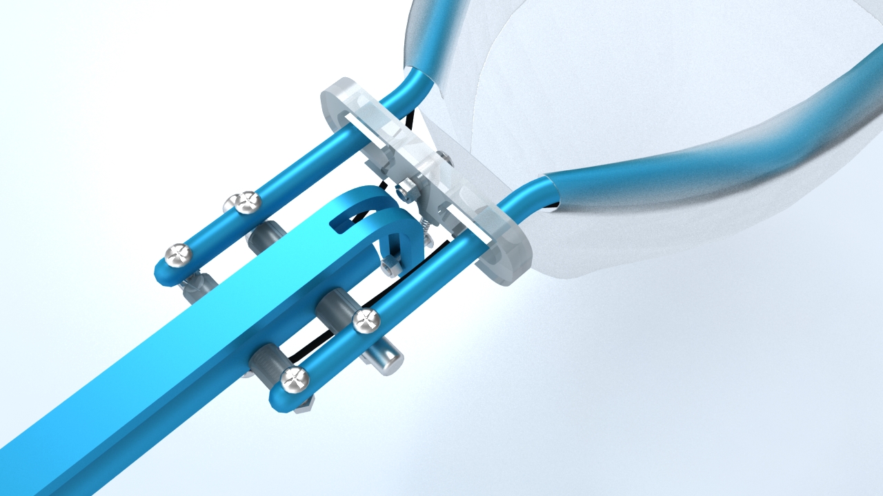 Phidos-Bag-N-Seal - Invention Assistant