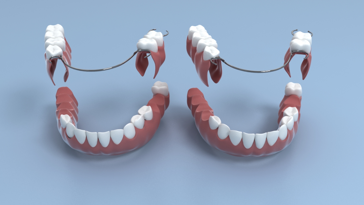 Comfort Bridge - Invention Assistant